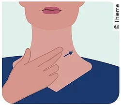 Schildrüsenmassage: Effektive Hilfe bei Hashimoto, Knoten und mehr ...